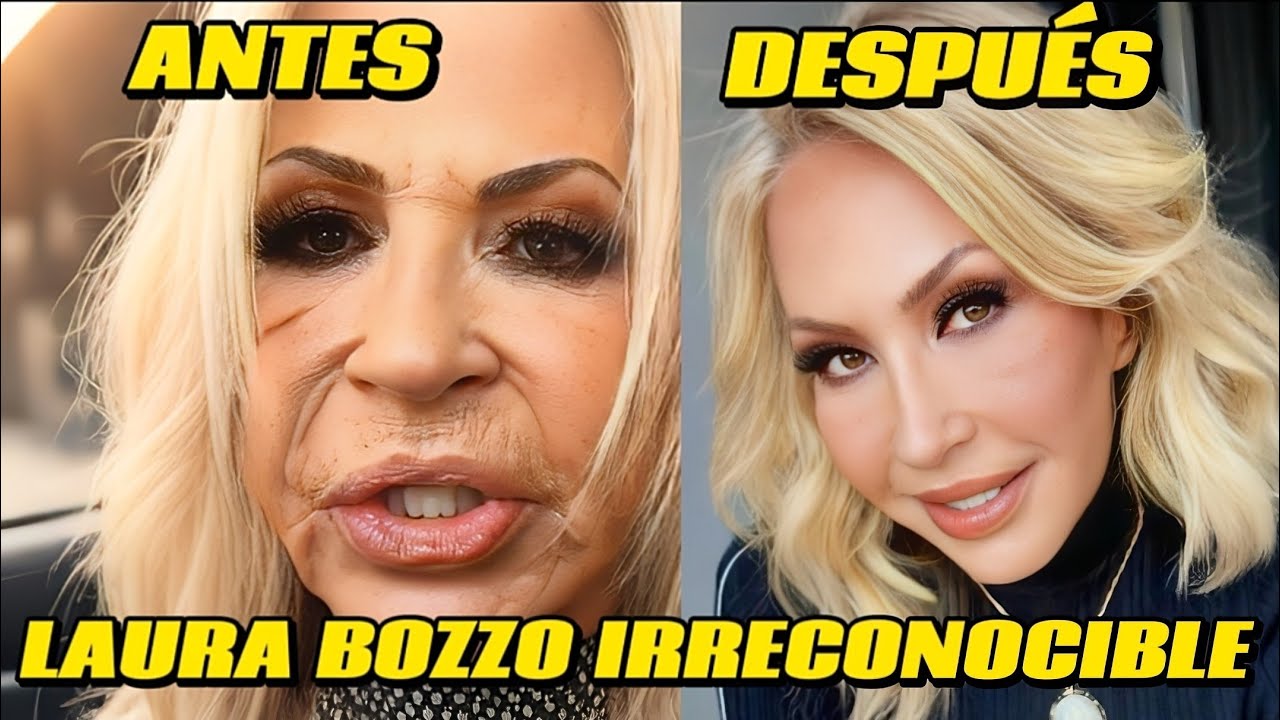 LAURA BOZZO: LUCE IRRECONOCIBLE DESPUÉS DE CIRUGÍA - YouTube