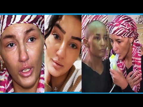 Xərçəng xəstəsi olan Aytən görün kimi axtarır? Parkda yata-yata başıma... Seni axtariram 21.07.2021
