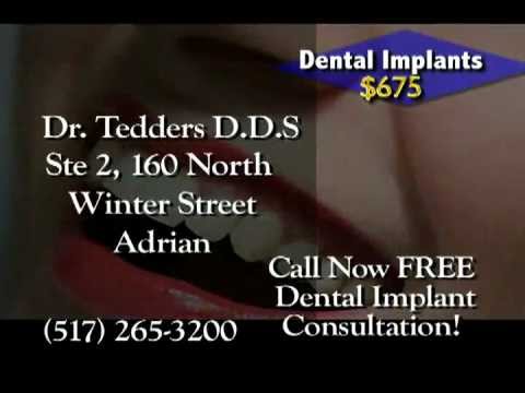 Dr. Tedders Dental Implant Commercial! - YouTube