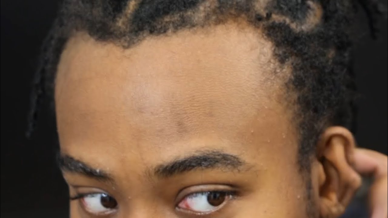 How I fixed his hairline - YouTube