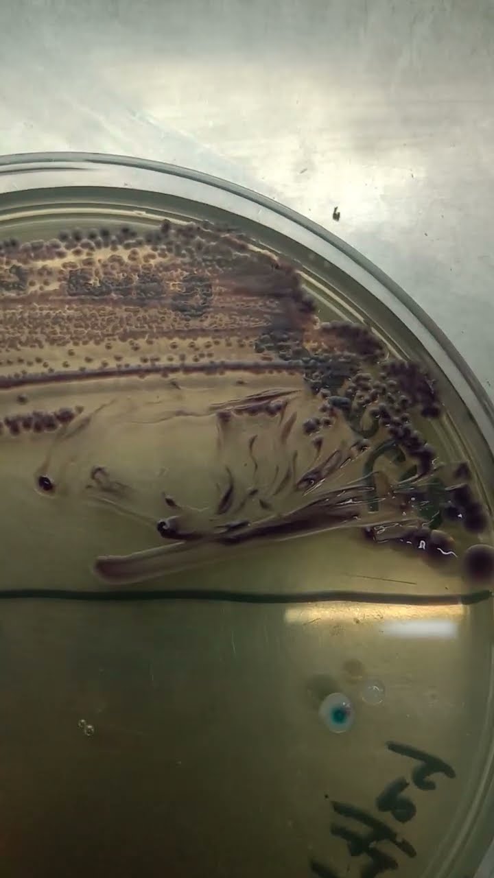 Urine sample growth on E. coli in hicrome uti agar # microbiolosit ...