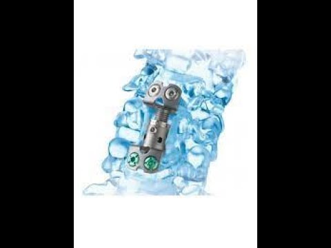 Anterior cervical Corpectomy with Fusion (ACCF)-Surgical Technique ...