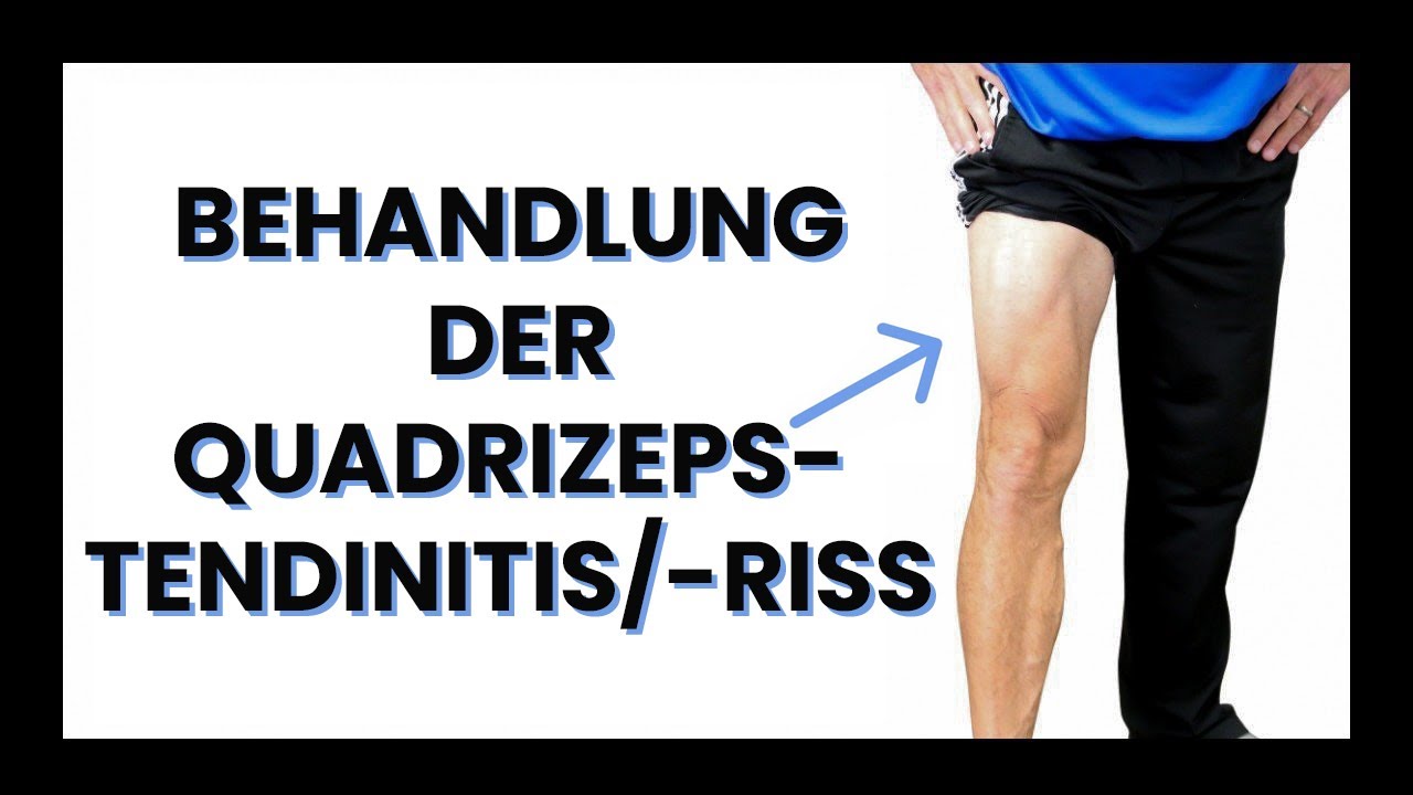 Quadrizepssehnenentzündung oder -riss: Die beste Selbstbehandlung - YouTube