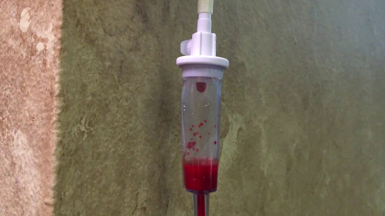 Ozone & UBI IV treatment - YouTube