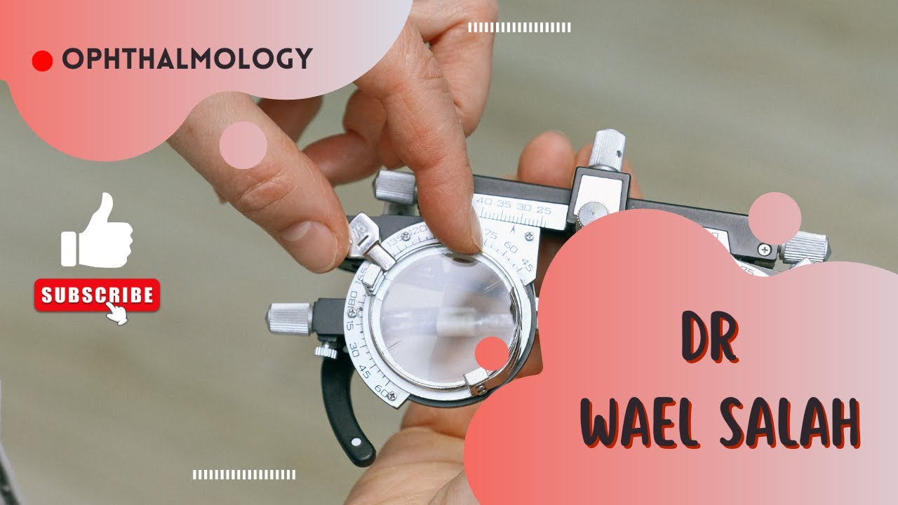 14.Ophthalmology module Dr. Wael Salah (2021) - Lens - 4 Types of ...