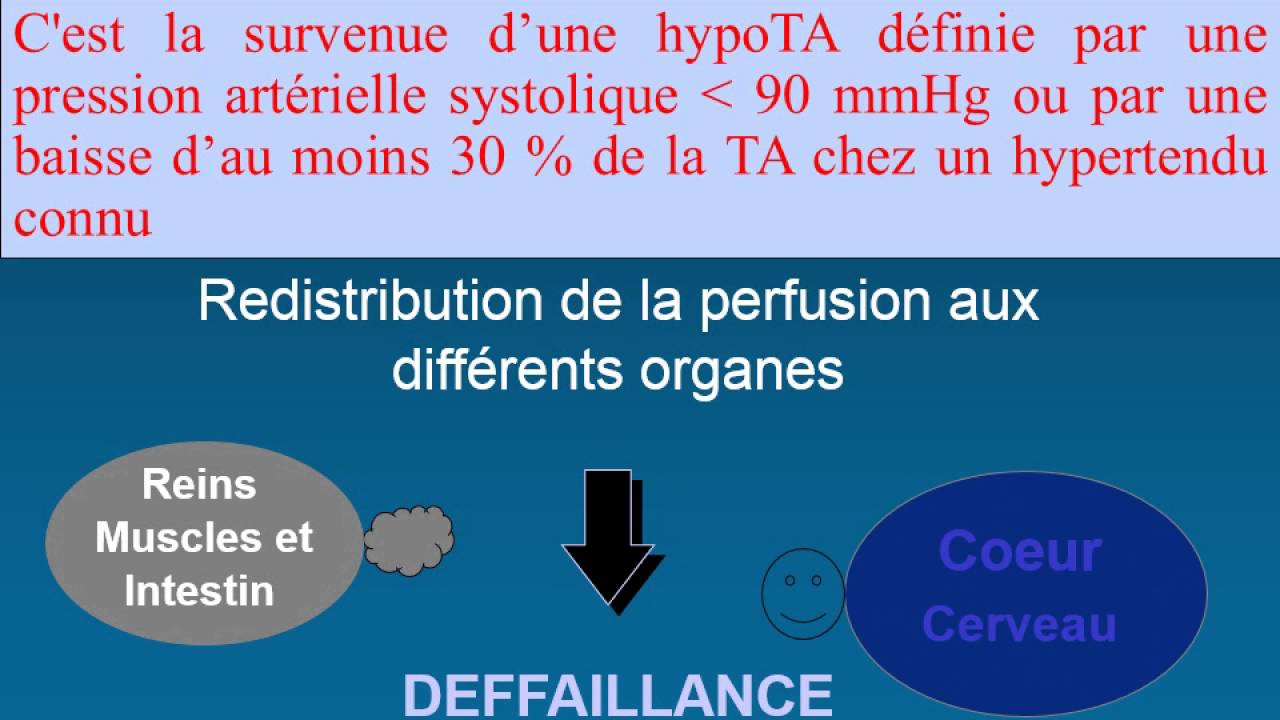 CARDIOLOGIE choc et collapsus - YouTube