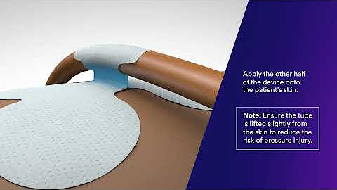 How to Use: 3M Securement Devices and Dressings - YouTube