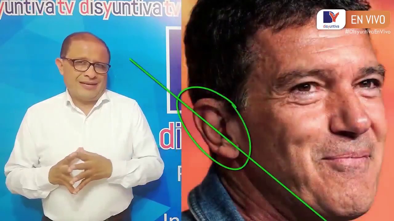 Sinal De Frank Leve - RETOEDU