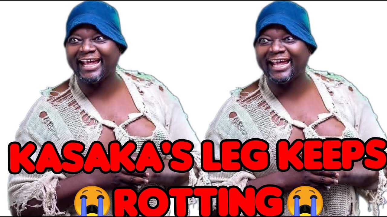MY LEG😪💔💔 IS ROTTING ZAMBIAN FAMOUS COMEDIAN KASAKA PLEADS 😭😭 FOR HELP ...