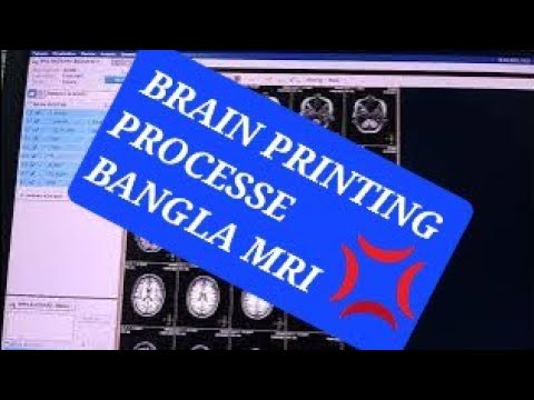 BANGLA MRI BRAIN NORMAL PRINTING - YouTube