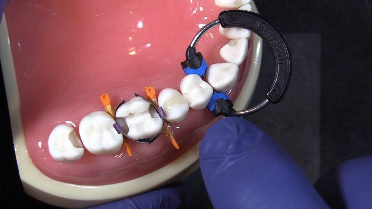 The Composi-Tight Soft Face 3D XR Ring from Garrison - YouTube