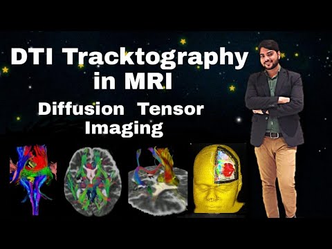 How Can DTI Post processing 3D imaging in MRI or DTI Tracktography ...
