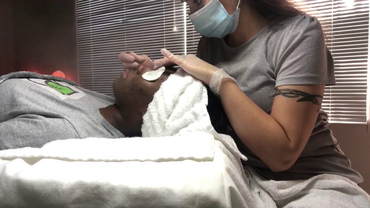 Gentle extractions of the nose during acne facial - YouTube