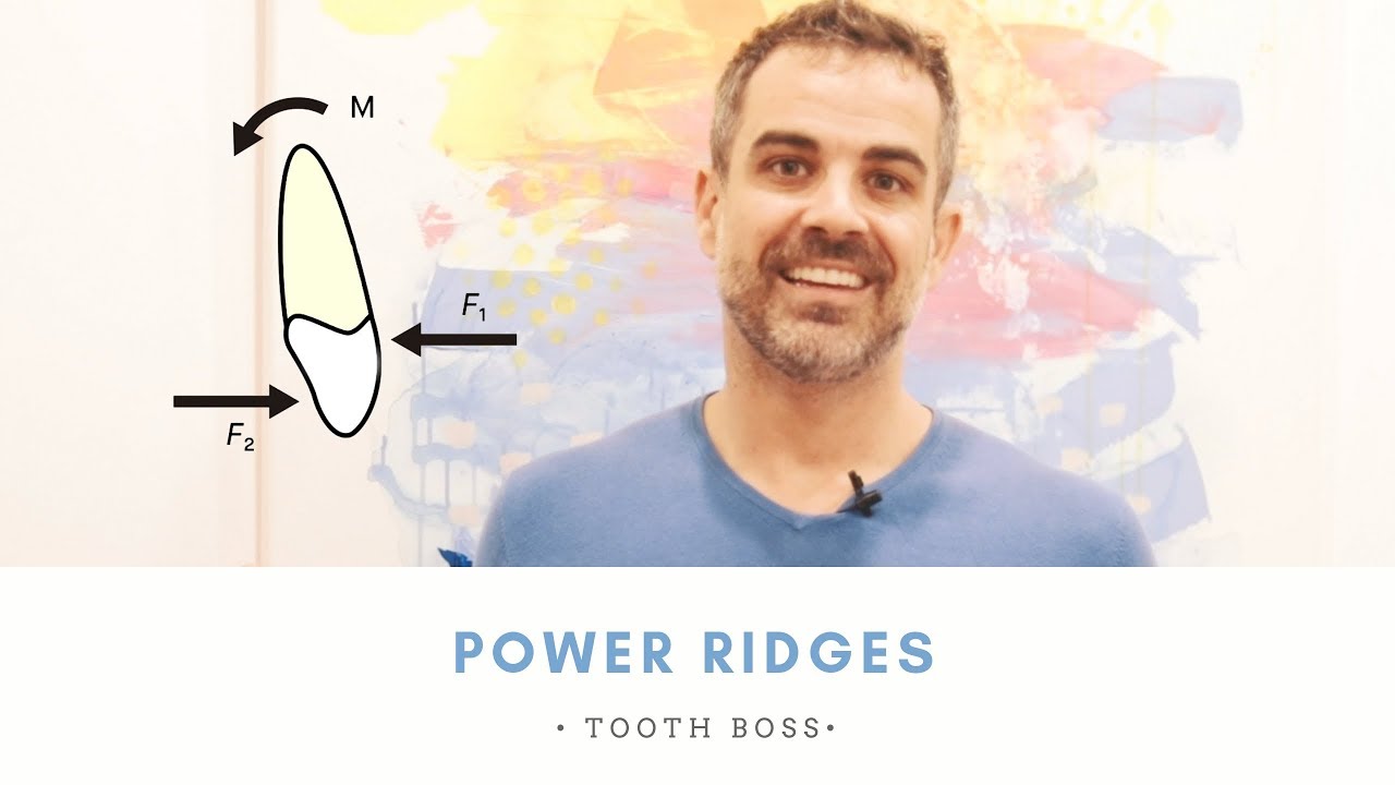 TOOTH BOSS || ¿Qué son los Power Ridges? || Ortodoncia en Murcia - YouTube