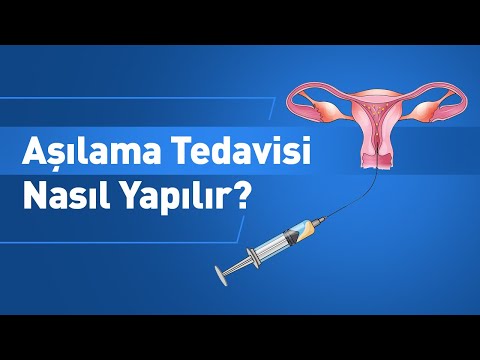 Aşılama Tedavisi Nedir? Tedavinin Başarsız Olduğu Nasıl Anlaşılır? Başarıyı Arttıran Faktörler