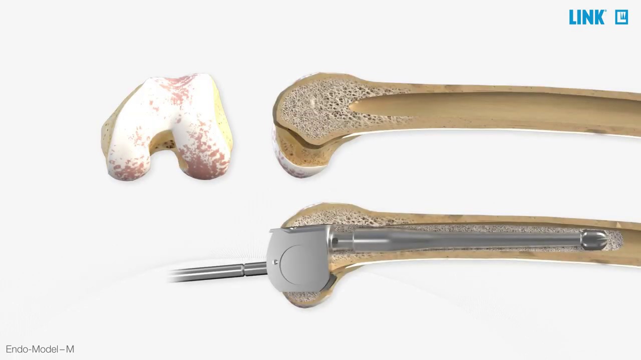 Endo Modell – M 3D OP - YouTube