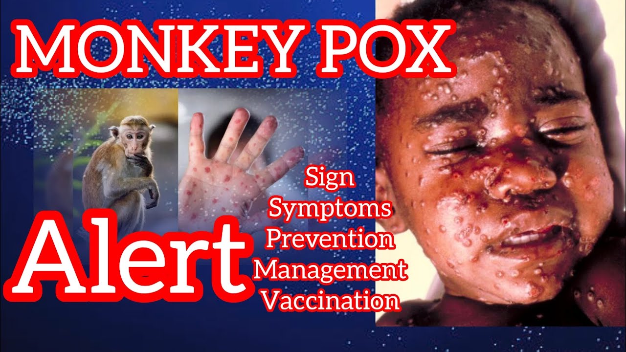 मंकीपॉक्स भारत में? | MPox Virus | Monkey Pox | INDIA | WHO Warning | # ...