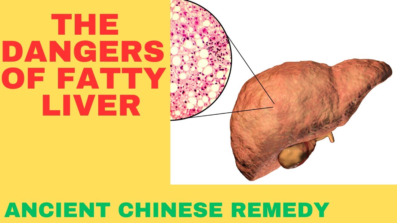 Ancient Secrets for Ailments. Curing Fatty Liver with TCM - YouTube