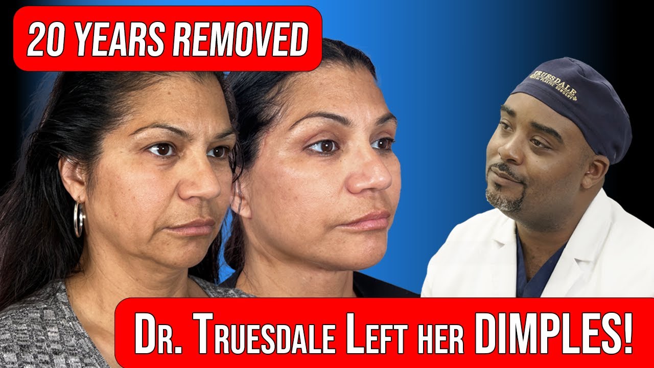 "I Still Have My Dimples!" Watch Her Stunning Surgical Makeover - YouTube
