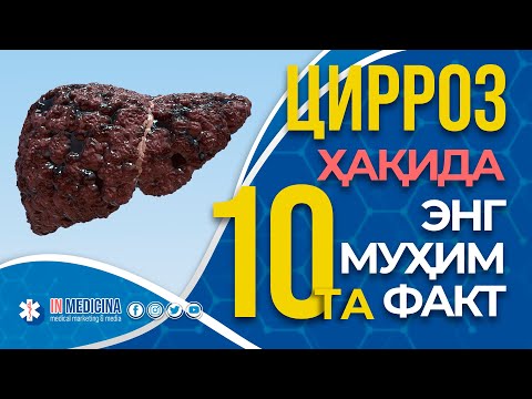 Жигар циррози ҳақида энг муҳим ҳақиқатлар. #inmedicina #cirrosis #siroz #sirros #jigarsirozi
