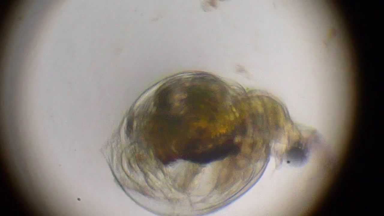 Ceriodaphnia dubia 3 - YouTube