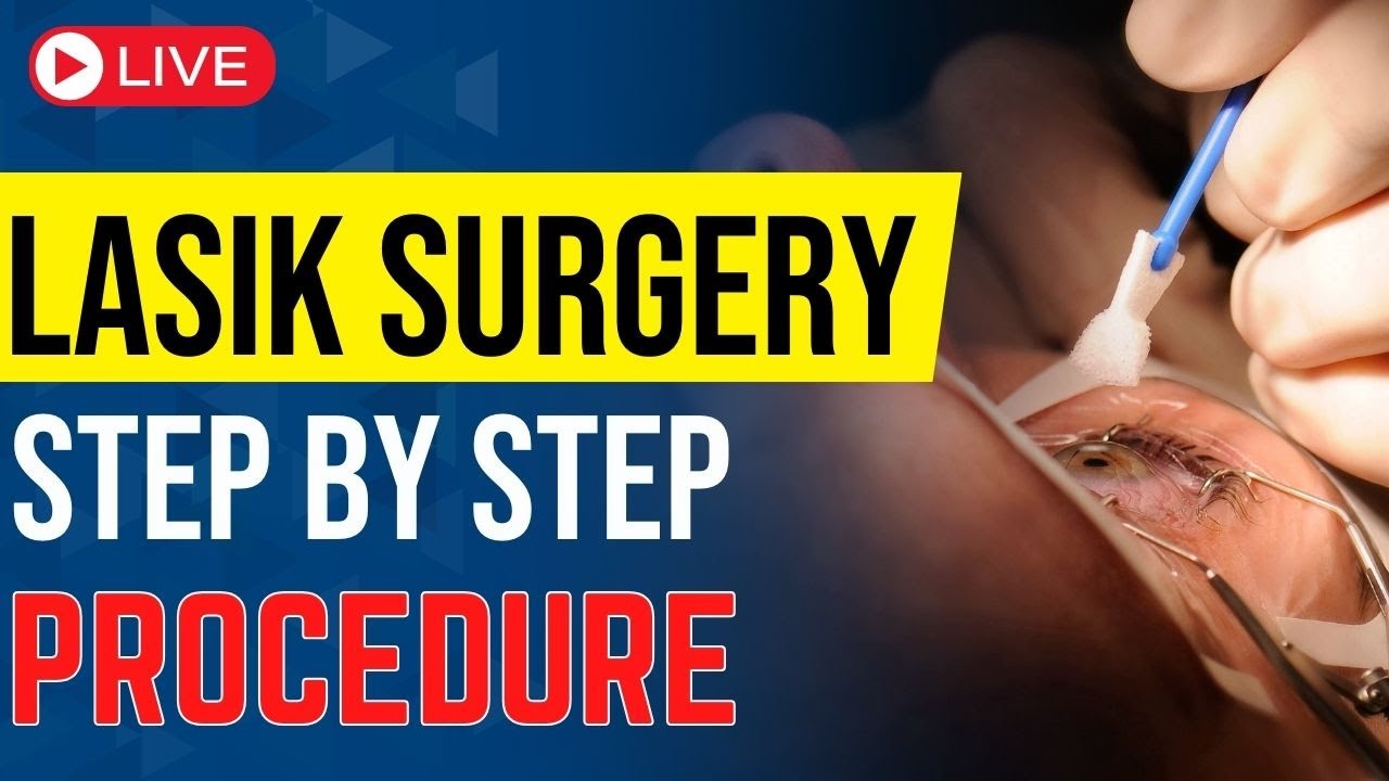 Live Lasik Surgery Video I Lasik Step By Step Procedure - YouTube