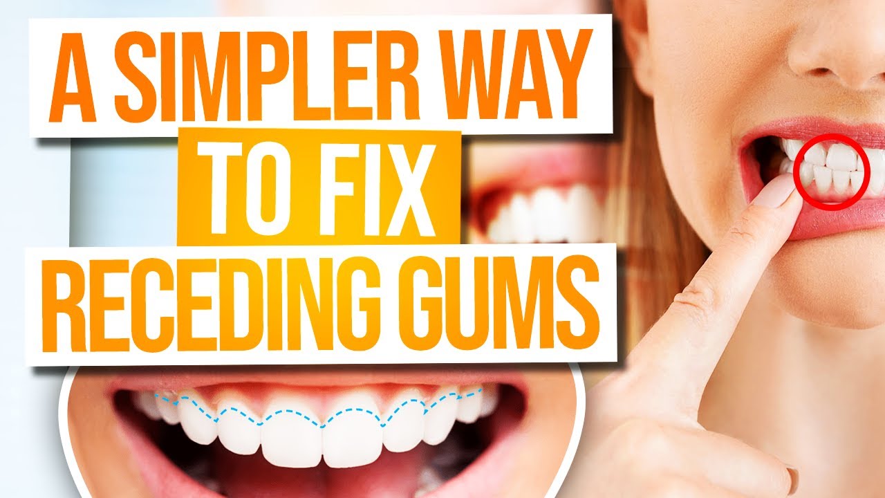 A Simpler Way to Fix Receding Gums - YouTube
