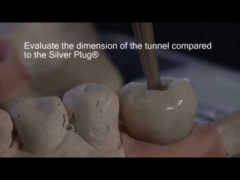 SILVER PLUG ENG - YouTube