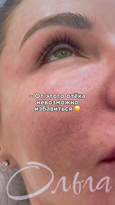 До после работа с отёком 👩‍⚕️ Youtube
