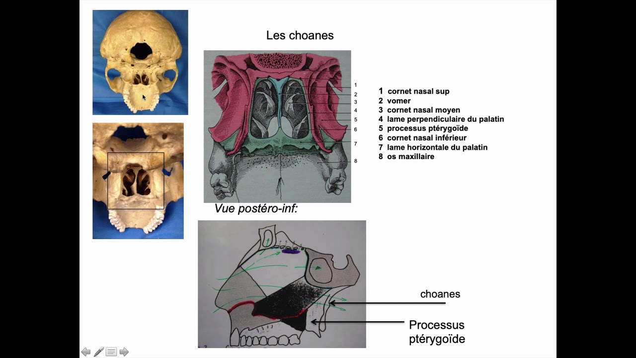 Cavités nasales : limites osseuses et pyramide nasale, sinus aériques ...