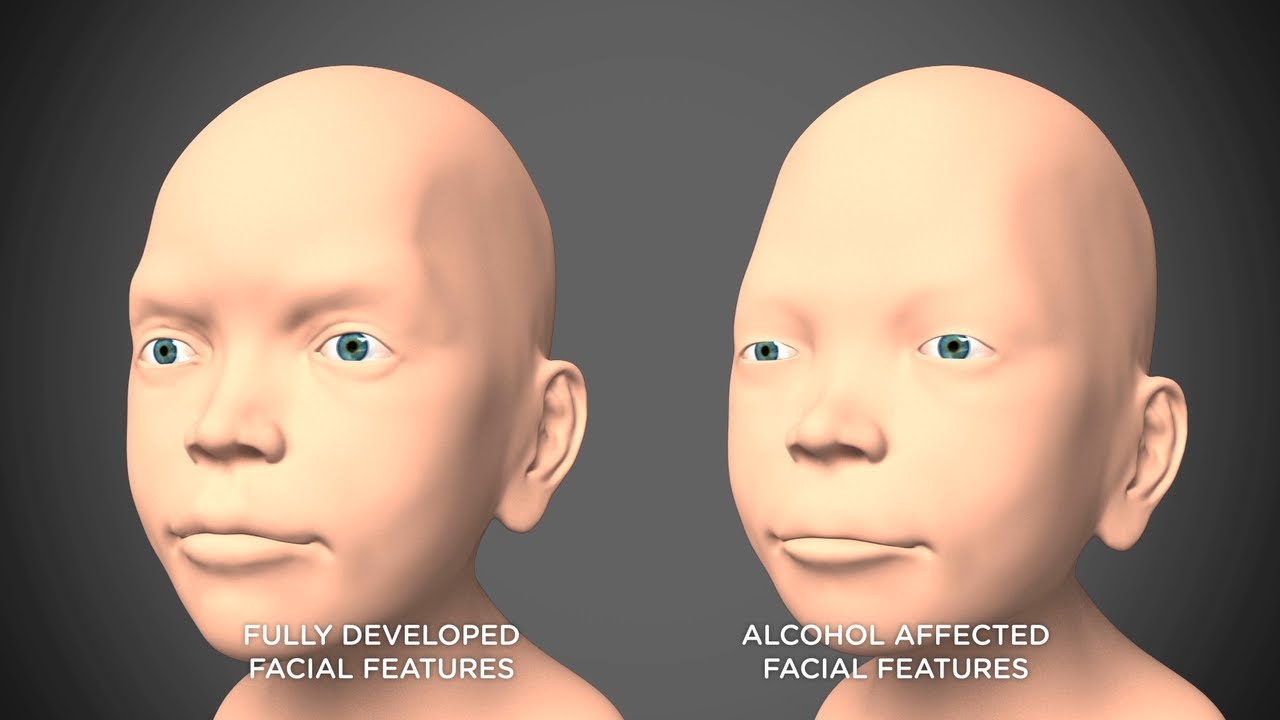The Impact of Drinking Alcohol at Difference Times During Pregnancy ...