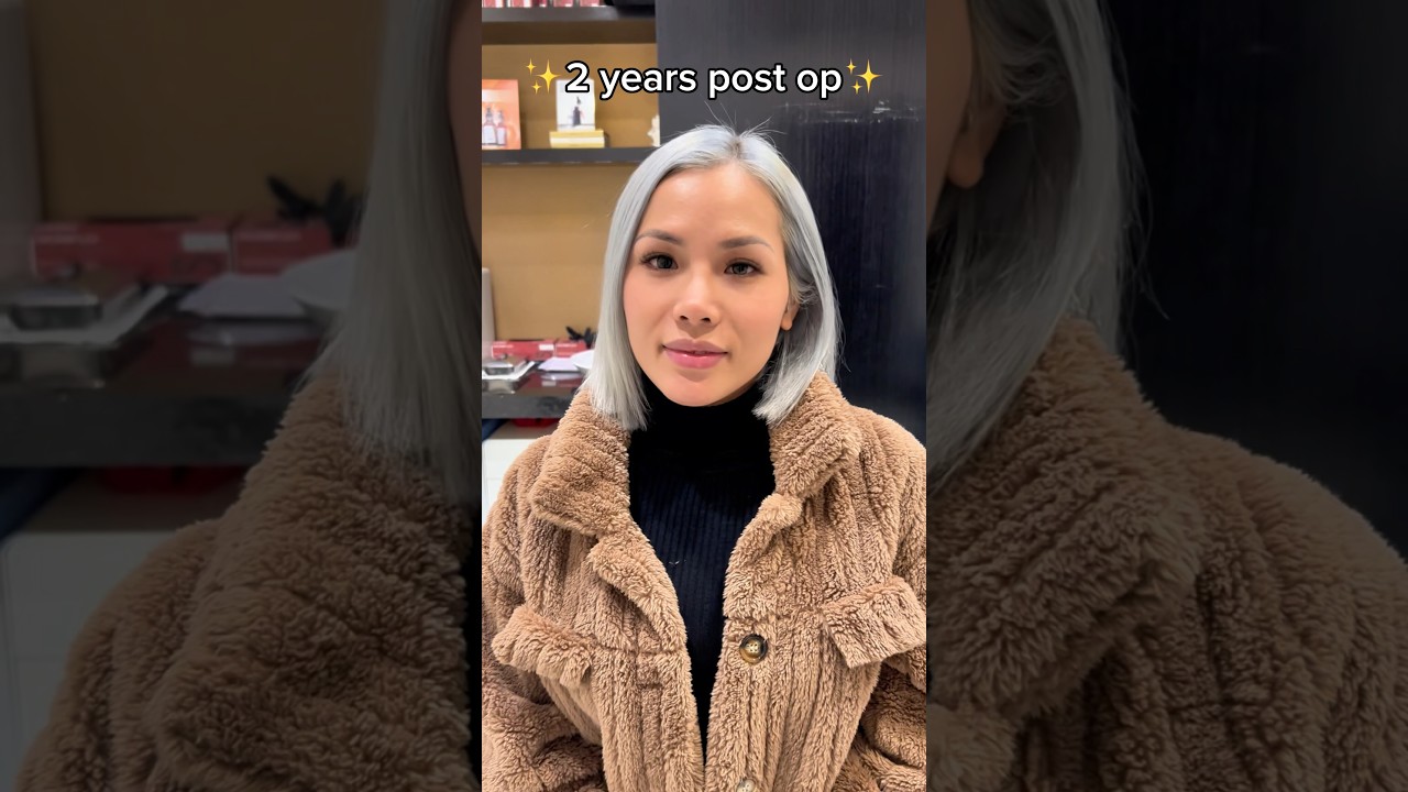 #YOOnose DCF Rhinoplasty with rib cartilage by Dr. Donald B. Yoo. 2 ...