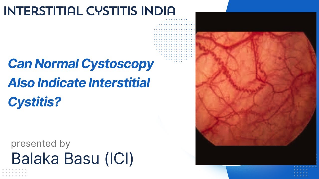 Cystoscopy Kya Hoti Hai? Is It Possible to Get a Normal Cystoscopy in ...