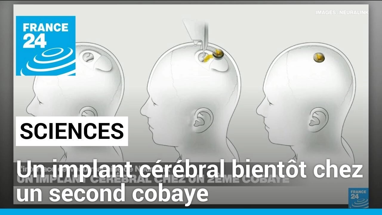 Neuralink : un implant cérébral bientôt chez un second cobaye • FRANCE ...