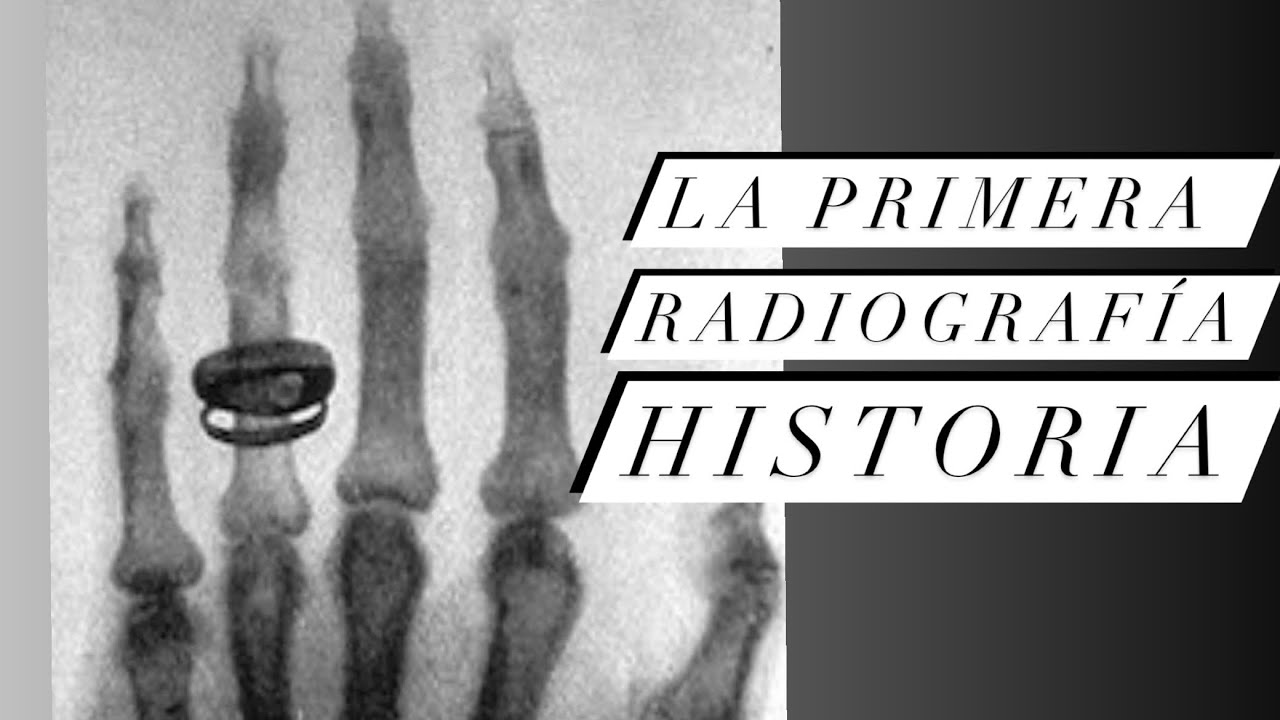 La Primera Radiografía: Una Revelación Invisible al Ojo Humano 🥇 - YouTube