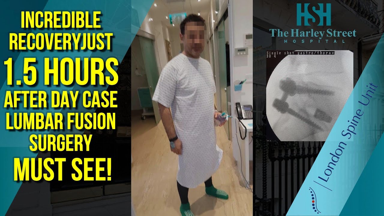 Incredible Recovery Just 1.5 Hours After Day Case Lumbar Fusion Surgery ...