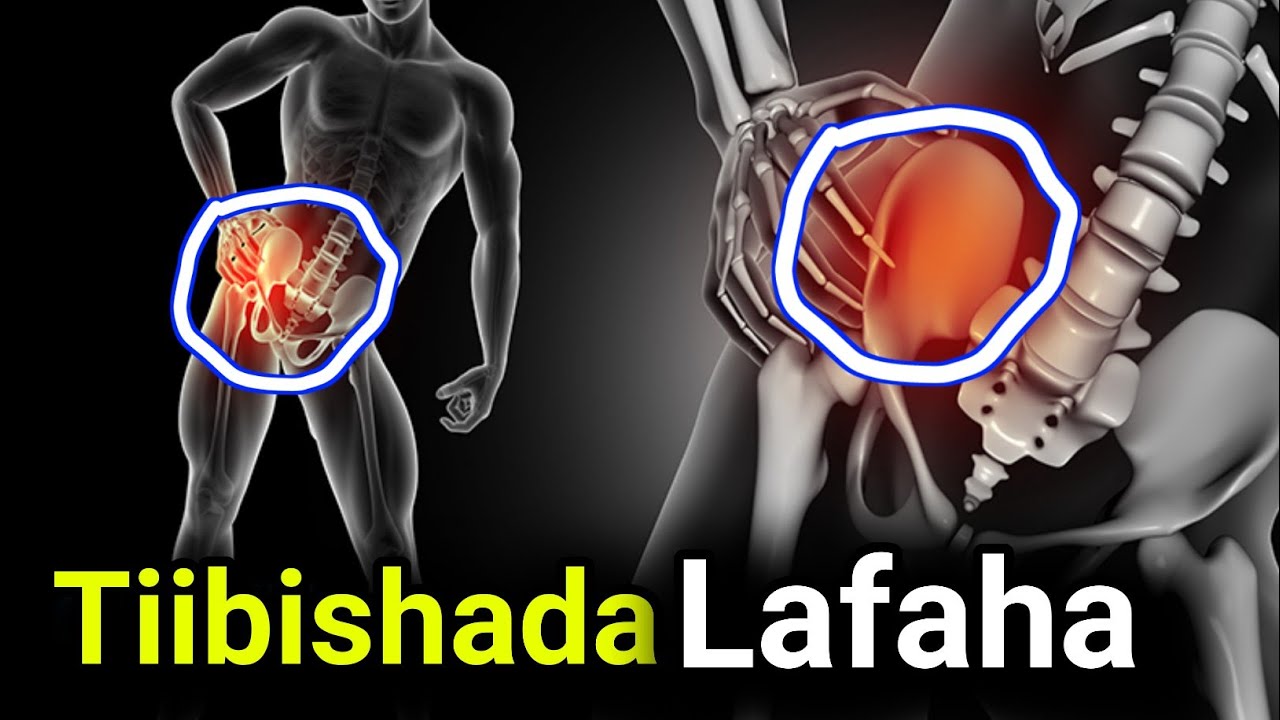 Halista Tiibishada lafaha ee lagu qaldo xanuunada roomatiisimka iyo ...