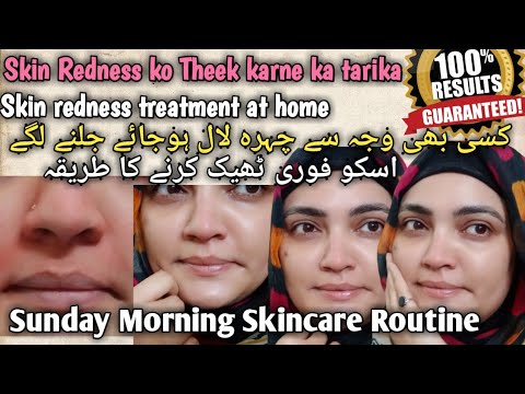 skin red ho jaye to kya karna chahiye|skin redness treatment-how to ...