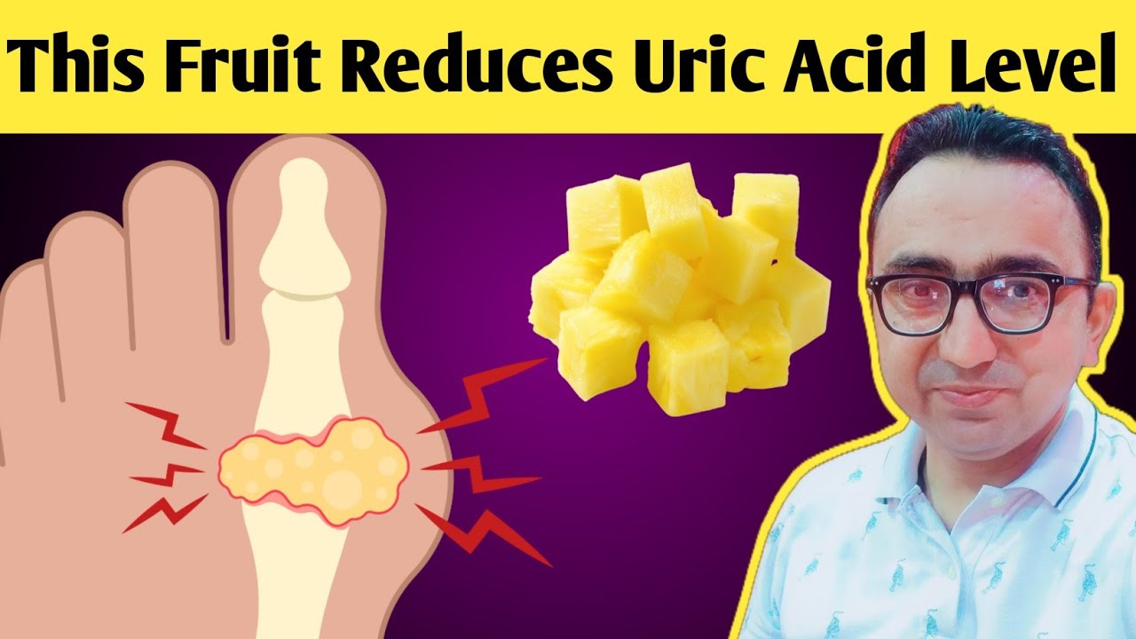 Top 5 Fruits That Reduce Uric Acid And Prevent Gout! - YouTube