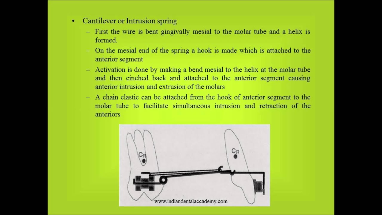 Three piece intrusion arch / certified orthodontic courses by Indian ...