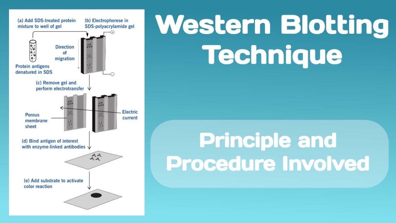 Western Blotting Technique Principle Procedure And Western Blotting Technique Principle Procedure And