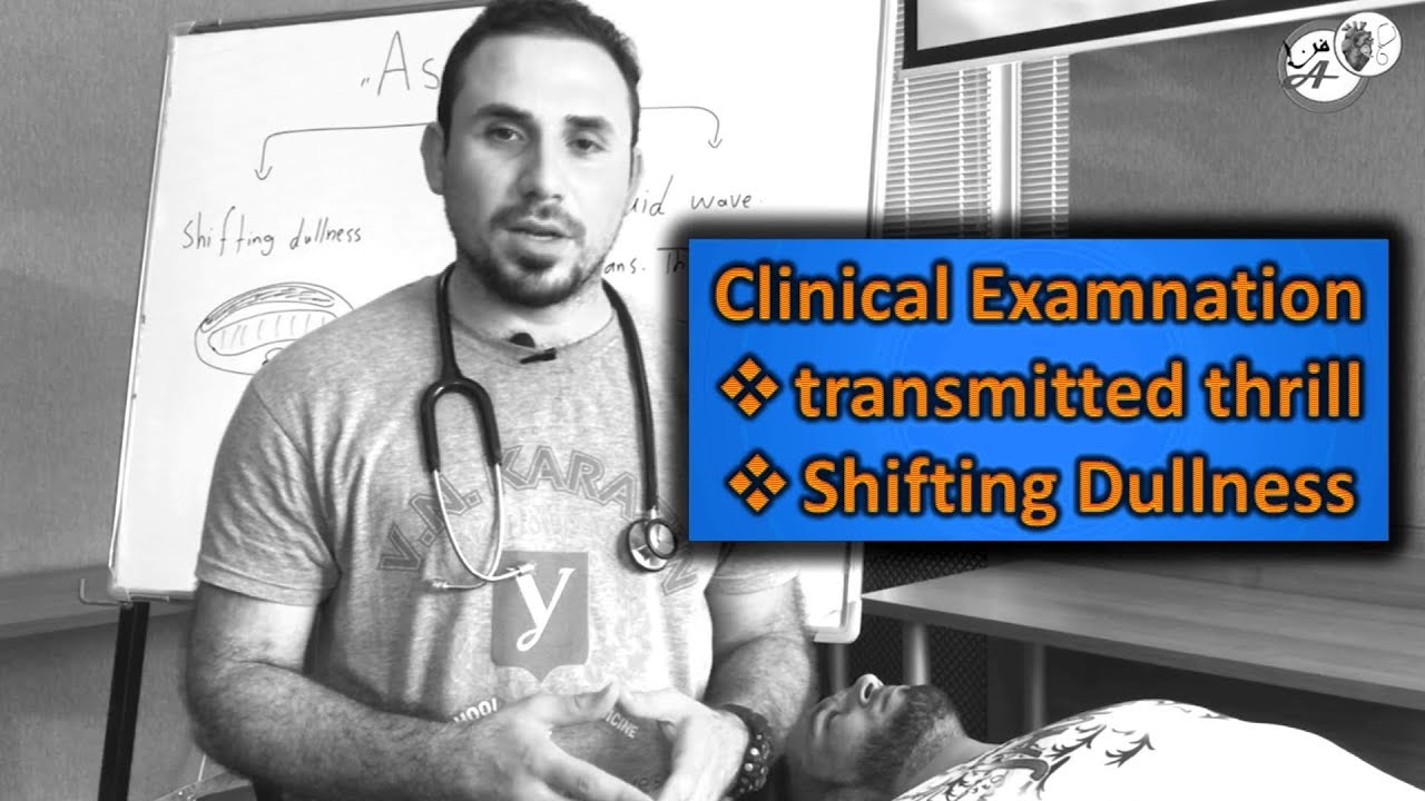 Clinical Examination: Ascites transmitted thrill Shifting Dullness I ...