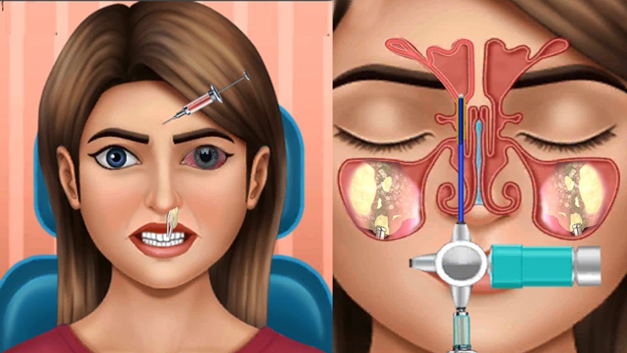 ASMR Sinus Surgery Animation | ASMR Eyes Care | Satisfying | ASMR ...