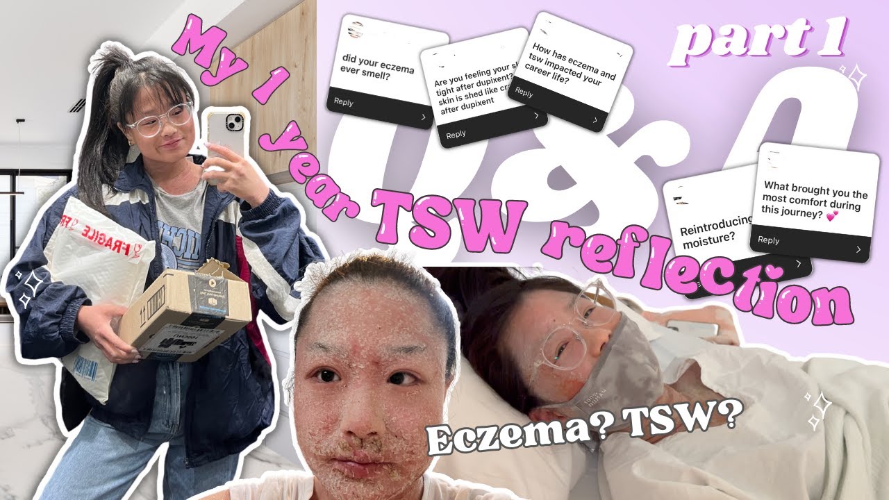 Reasons why I decided to stop using steroid creams for my Eczema ...