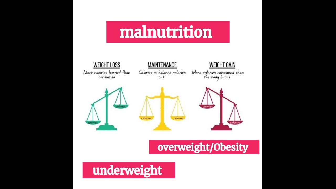 Malnutrition, Types of Malnutrition, Overweight/Obesity, Underweight ...