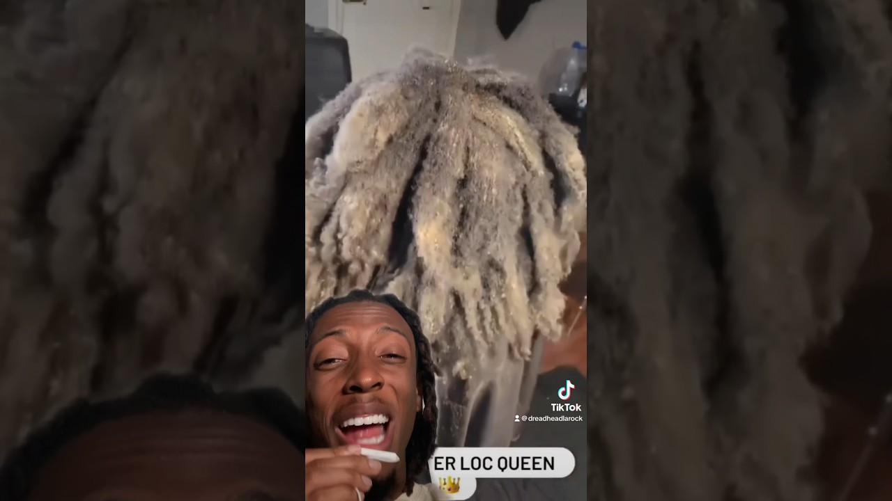 DISGUSTING DREADLOCK DANDRUFF! 🤢 - YouTube