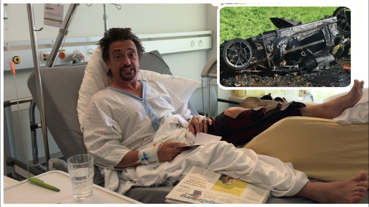Richard Hammond says he still lives with 'syndrome' as a result of ...