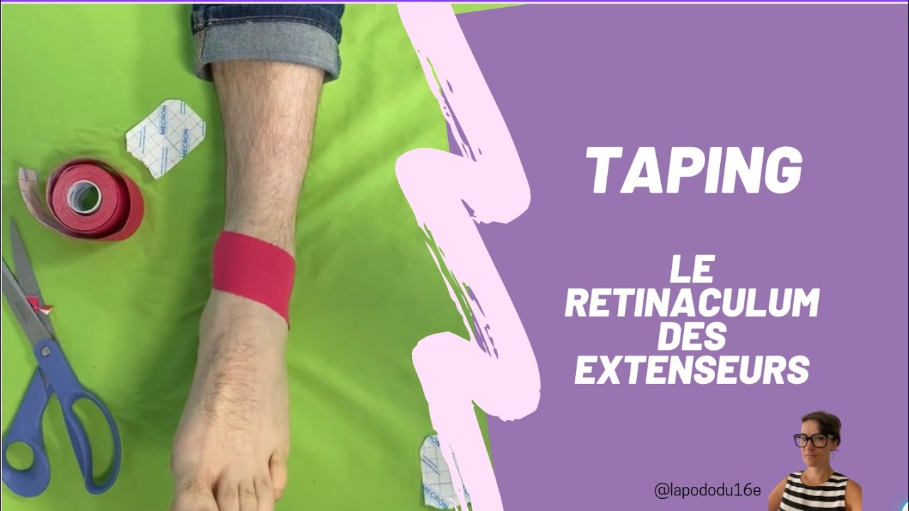 Taping : retinaculum des extenseurs - YouTube