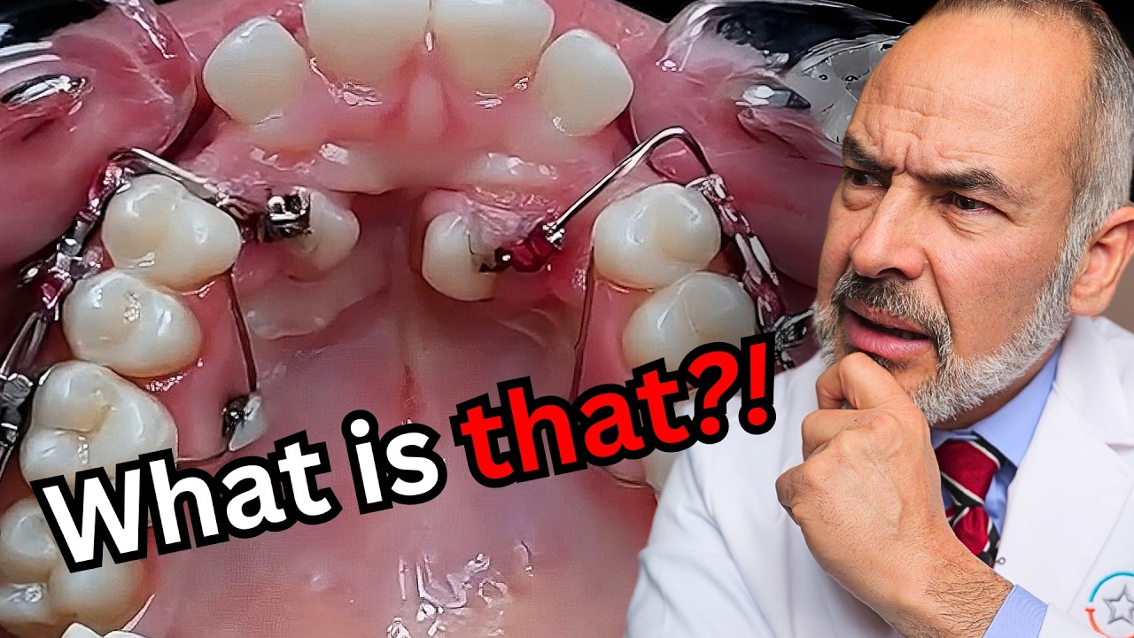 Orthodontist Reacts To The CRAZIEST Braces/Teeth - YouTube