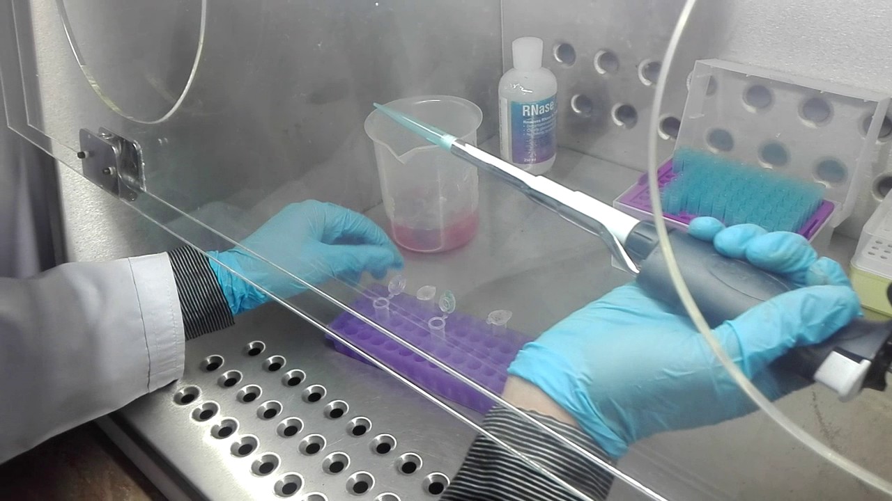 plasma separation from blood part 2 - YouTube